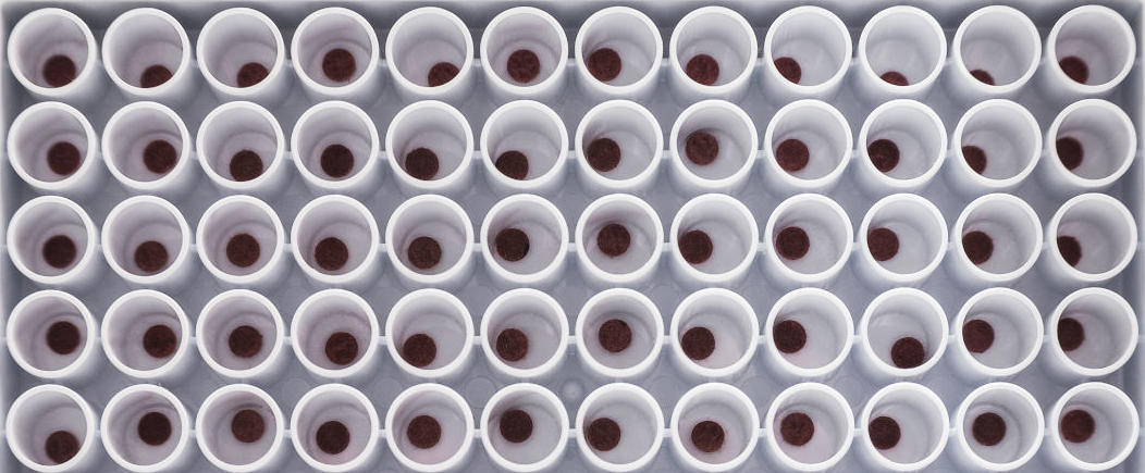 Dried blood spot tests | Masdiag